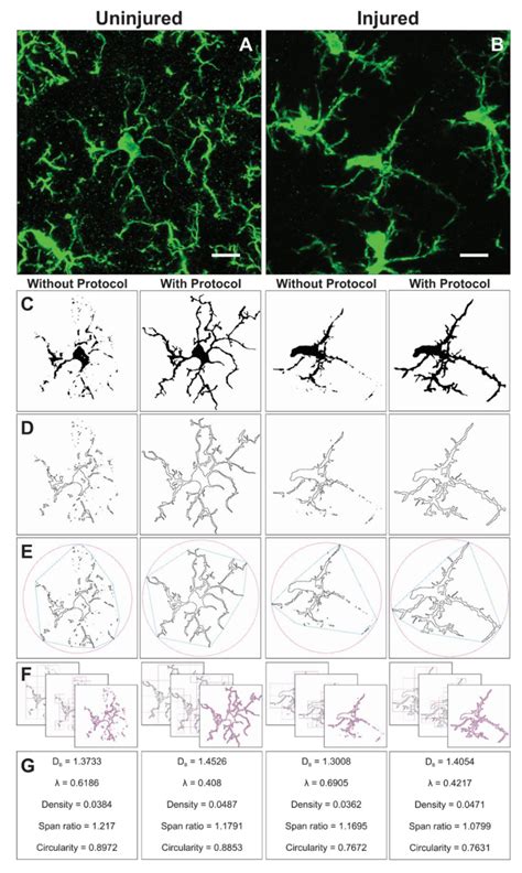 Quantifying Microglia Morphology From Photomicrographs Of Immunohistochemistry Prepared Tissue
