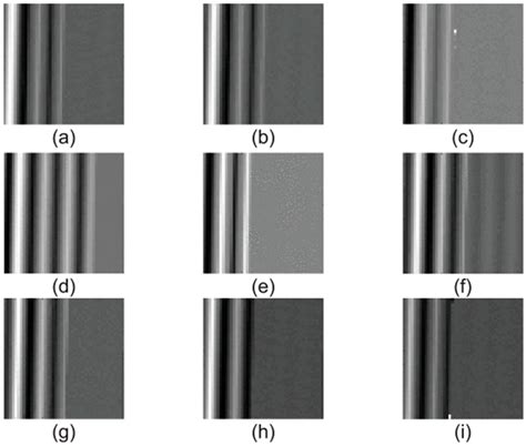 Fault Diagnosis Techniques For Electrical Distribution Network Based On Artificial Intelligence