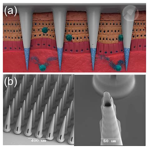 Photonic Metamaterial Based Near Field Enhanced Biosensing Approach For Early Detection Of Lung