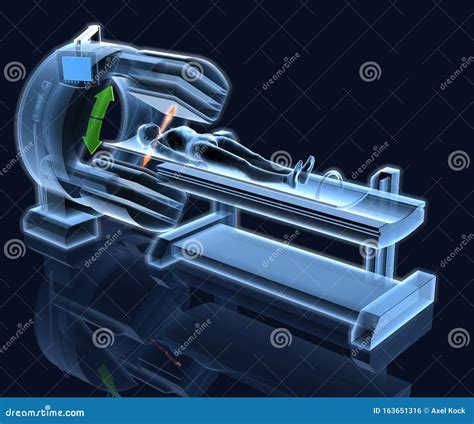 Thyroid Scan Scintigraphy Medically 3d Illustration Royalty Free Cartoon