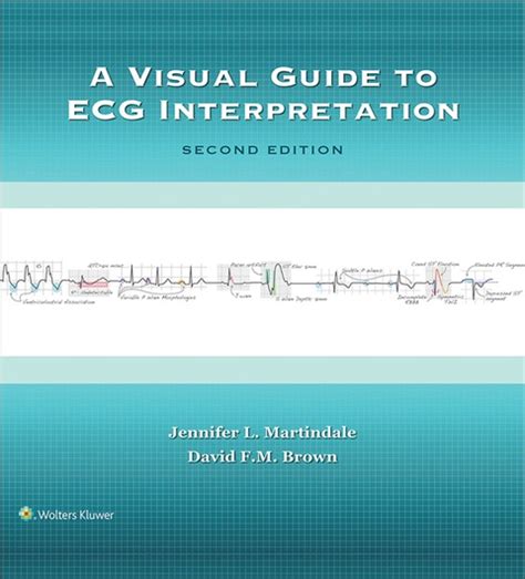 A Visual Guide To ECG Interpretation Ebook En LALEO