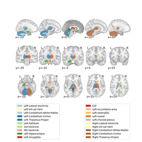 Selected Regions After One Vs One T Test Feature Selection Download Scientific Diagram