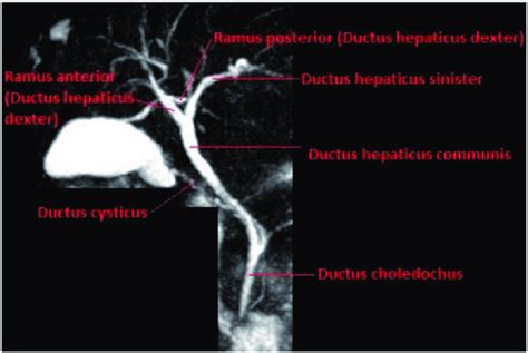 Bile Duct D1 Type Variation Download Scientific Diagram