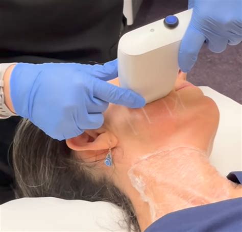 Sofwave Laser And Skin Surgery Center Of Northern California