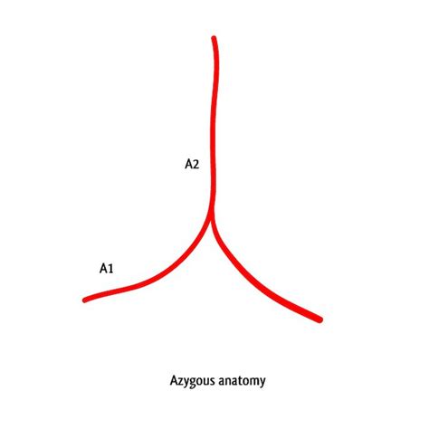Azygos Anterior Cerebral Artery Pacs
