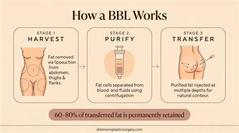 What Is A Bbl And What Does It Mean