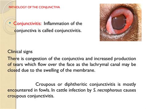 Affections Of Eye Ear By Dr Sanjiv Kumar 1 Pptx