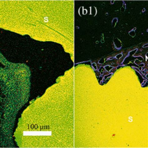 Histological Analysis Of New Bone Formation Around The Download