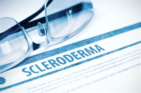 Potential Lung Disease Biomarker Discovered In Scleroderma Patients Clinical Lab Products