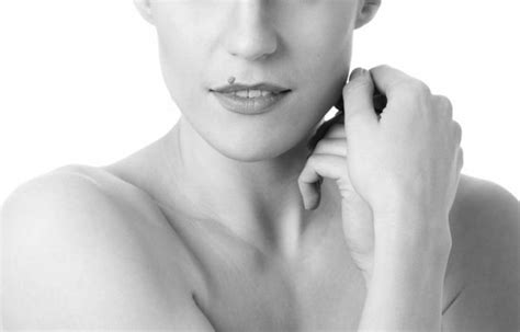 Uklanjanje MladeŽa Evo Šta Morate Znati Pre Nego što Odete Na