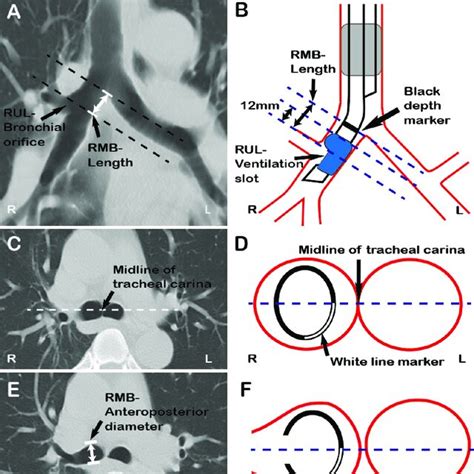 Ct Measurements In Imaging Window And Schematic Diagram Of The Optimal Download Scientific