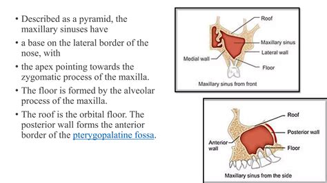 Maxillary Sinus Part 1 Pptx