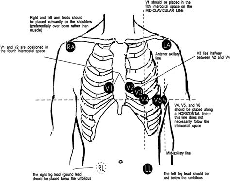 Electrocardiogram The Recording Of Electrical Activities Of The Heart