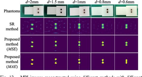 Figure 12 From Image Reconstruction For Magnetic Particle Imaging Based