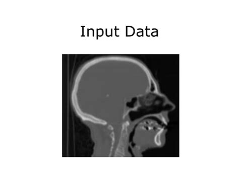 Ppt Volume Rendering And Shear Warp Factorization Powerpoint