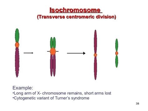 Isochromosome 17q