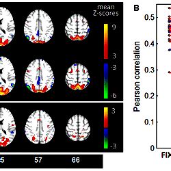 Effects Of Pipeline Optimization On Group Level Activation Strong Contrast