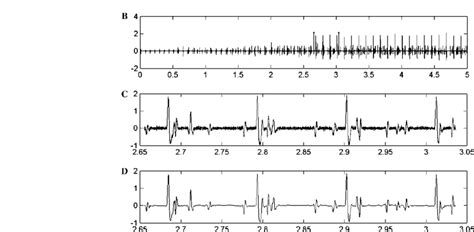 An Example Of Denoising Process Based On The Wavelet Filtering And Download Scientific Diagram