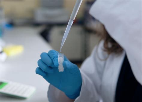 Direct Sequencing Sanger Sequencing Method Gdl