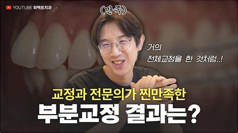 클리피씨 부분교정 기간 결과 치아교정 전후🦷 Youtube
