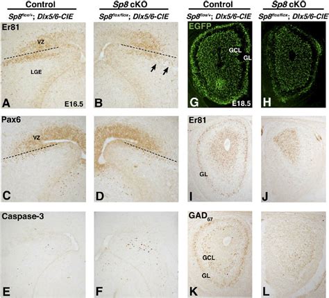 Sp8 Conditional Mutants Exhibit Embryonic Defects In The Dlge And