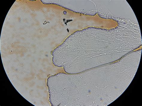 Zit Pus Under Microscope