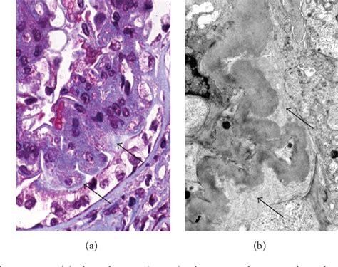Table 1 From Practical Application Of Columbia Classification For Focal