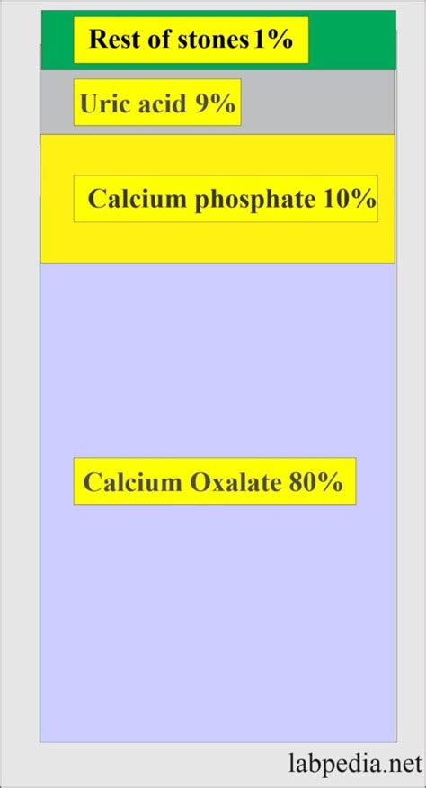 Renal Stone Analysis Nephrolithiasis Procedure For Stone Analysis