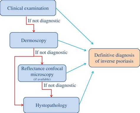 Inverse Psoriasis From Diagnosis To Current Treatment Options Pmc
