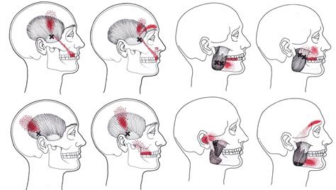 원인모를 치통 때문에 죽겠어요ㅠㅠ 이비인후과 가니 임파선 문제이고 귀도 부었다고 했고 치과에선 치아엔 문제없다구 씹을땐