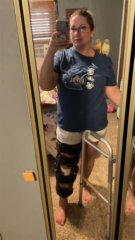 Positive Acl Surgery And Post Racl