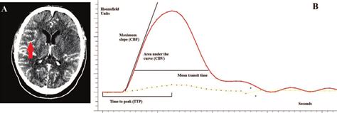 A An Arterial Input Function Aif Arrow On The Axial Ct Scan Is Download Scientific Diagram