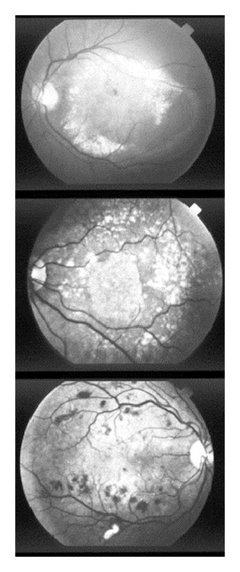 The Comparison Of Image Enhancement Results Of Three Images In The
