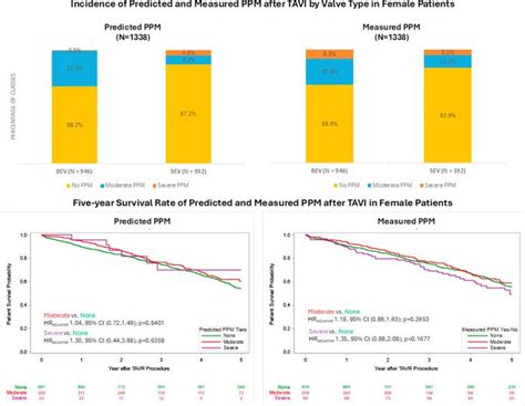 Incidence And Sex Based Comparison Of Prosthesis Patient Mismatch Ppm In Karim Al Azizi Md