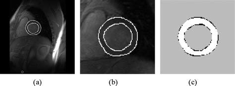 Segmentation Of Heart Ventricles A Ground Truth Endocardial And Download Scientific Diagram