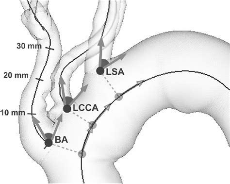 Calculation Of Branching Angle Of Ba Lcca And Lsa Branching Angle Download Scientific