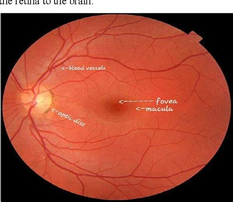 Figure 1 From Fovea Region Detection In Noisy Fundus Retinal Image Using Wavelet Transform And