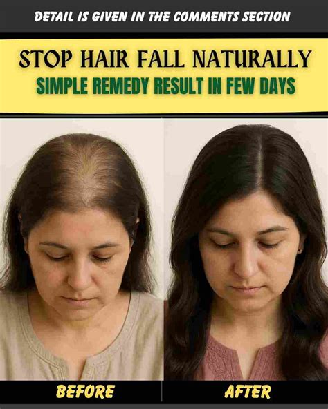 Stop Hair Fall Naturally Simple Remedy Result In Few Days V Beautify