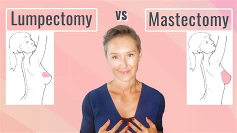 When Can I Lift More Than 10 Pounds After Mastectomy At Todd Briggs Blog