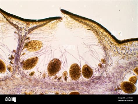 Light Micrograph Of Fucus Cross Section Of Receptacle Showing Conceptacle And Oogonia