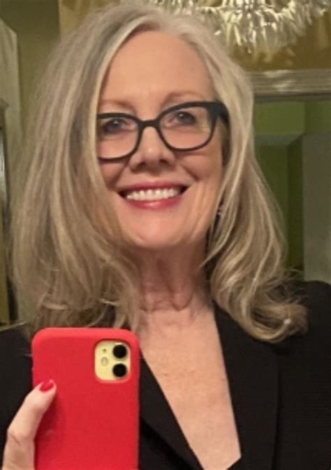 Composite Bonding Part 2 Rinvisalign