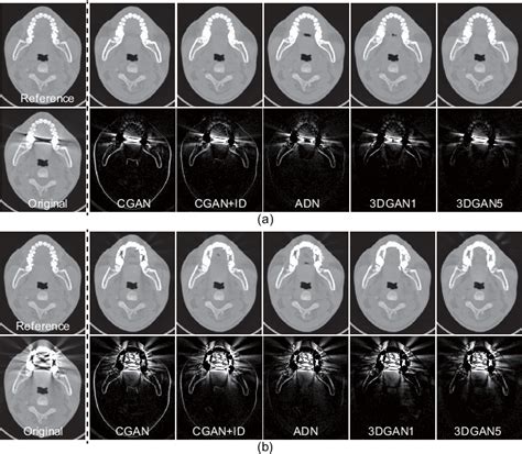 Figure 5 From Three Dimensional Generative Adversarial Nets For Unsupervised Metal Artifact