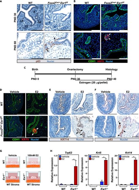 Estrogen Receptor Alpha Regulates Uterine Epithelial Lineage