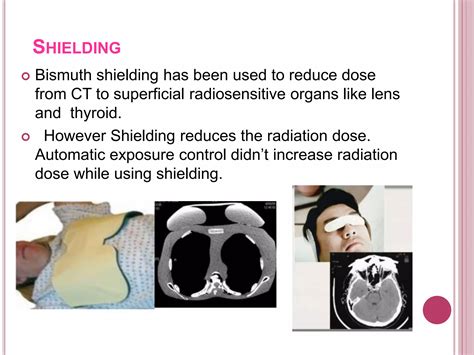 Ct Radiation Dose Reduction Pptx Digital Audio Computer Software