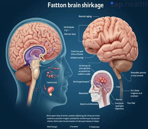 What Causes Shrinkage Of The Brain A Simple Guide To Brain Health