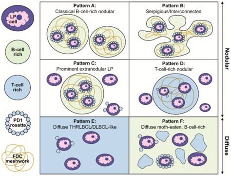 Pitfalls In The Diagnosis Of Nodular Lymphocyte Predominant Hodgkin