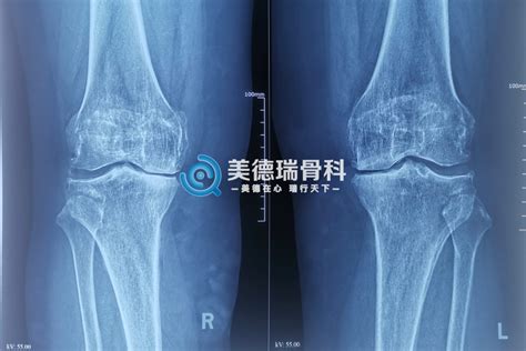 翁牛特旗妇幼保健院美德瑞骨科中心成功开展多台关节置换及创伤手术 北京美德瑞骨科医生集团官方网站