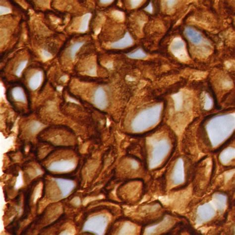 Brightfield Hdab Color Deconvolution Her2 Ihc In Qupath Image