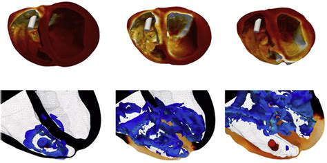 Cardiac Computational Modelling Revista Española De Cardiología