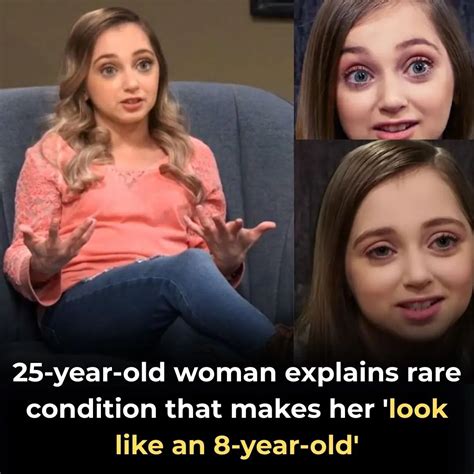 25 Year Old Woman Explains Condition That Makes Her ‘look Like An 8 Year Old